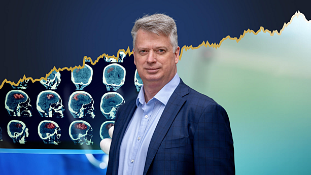 Telix eyes strong growth in 2025, but RFK Jr. poses a wildcard: Shane Fitzgerald - Vishal ...